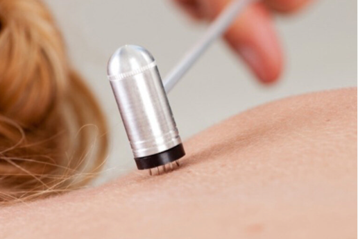 7 Star Needle Therapy Session – Green Acupuncture